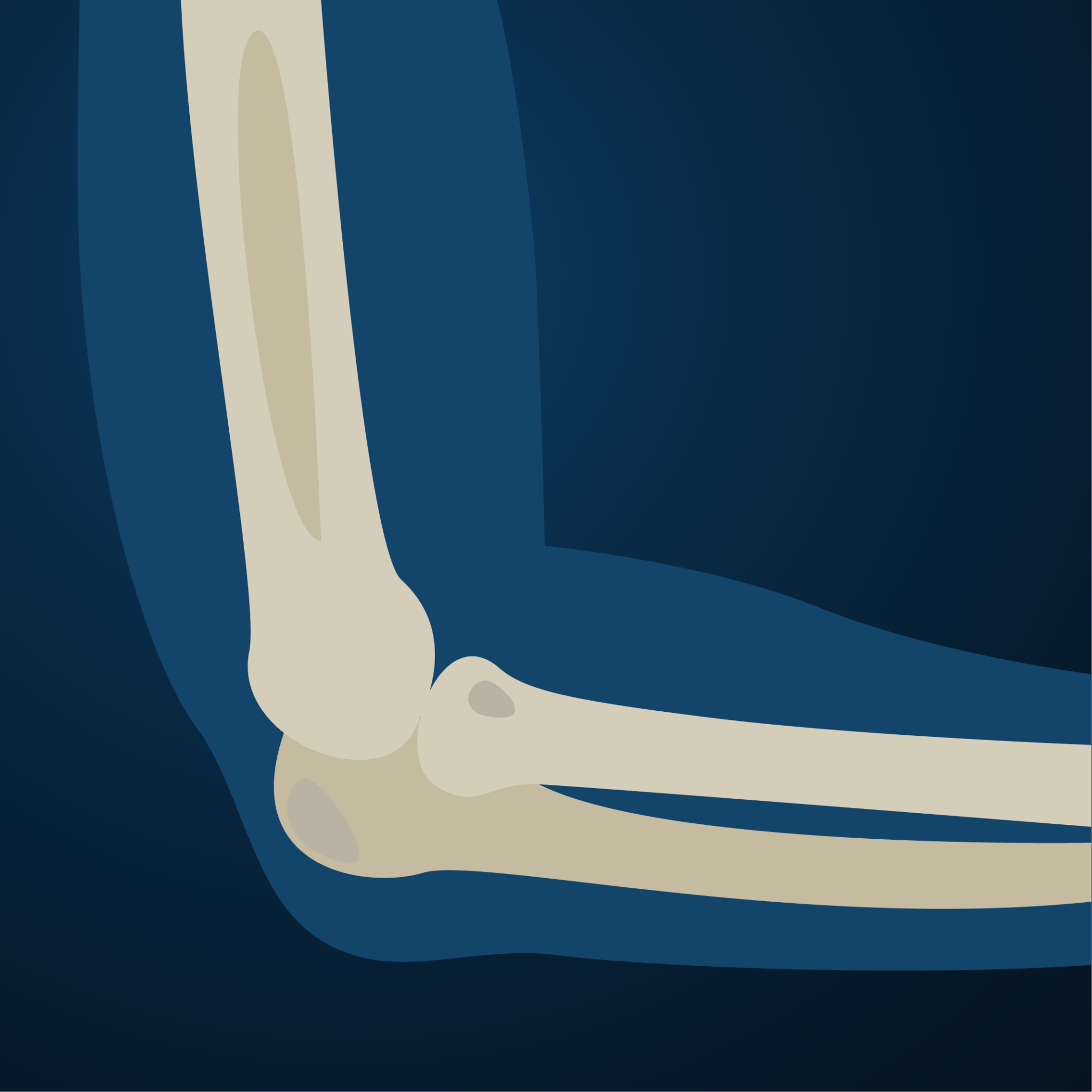 Elbow Anatomy, Injuries, and Treatment - Colorado Sports Doctor