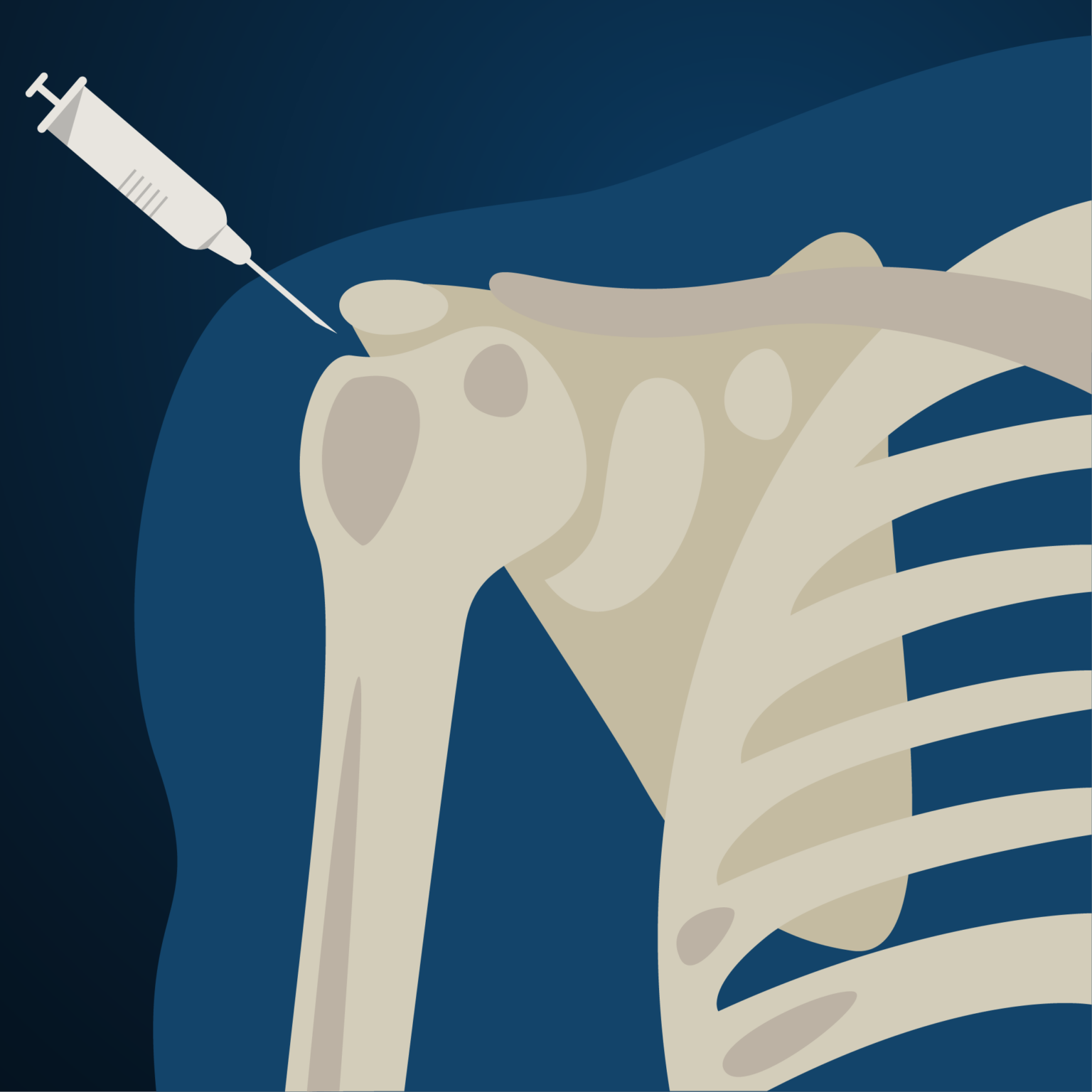 PRP Shoulder Treatments - Dr. Chris Jones Colorado Springs, CO